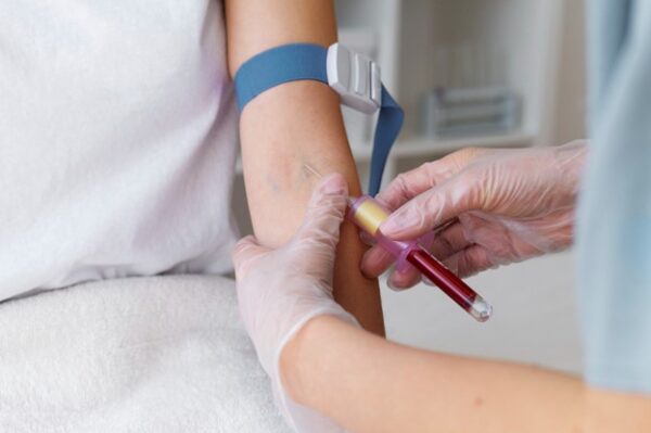 Understanding the Complete Blood Count Test: What Does It Mean for Your ...